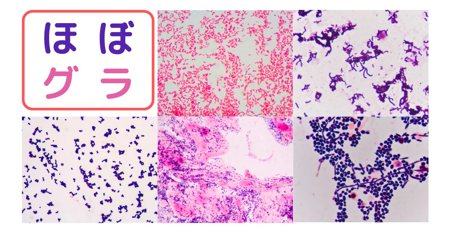 ディスク法による薬剤感受性試験で阻止円計測を正確に行うためのポイントは？ - カーブジェン＋